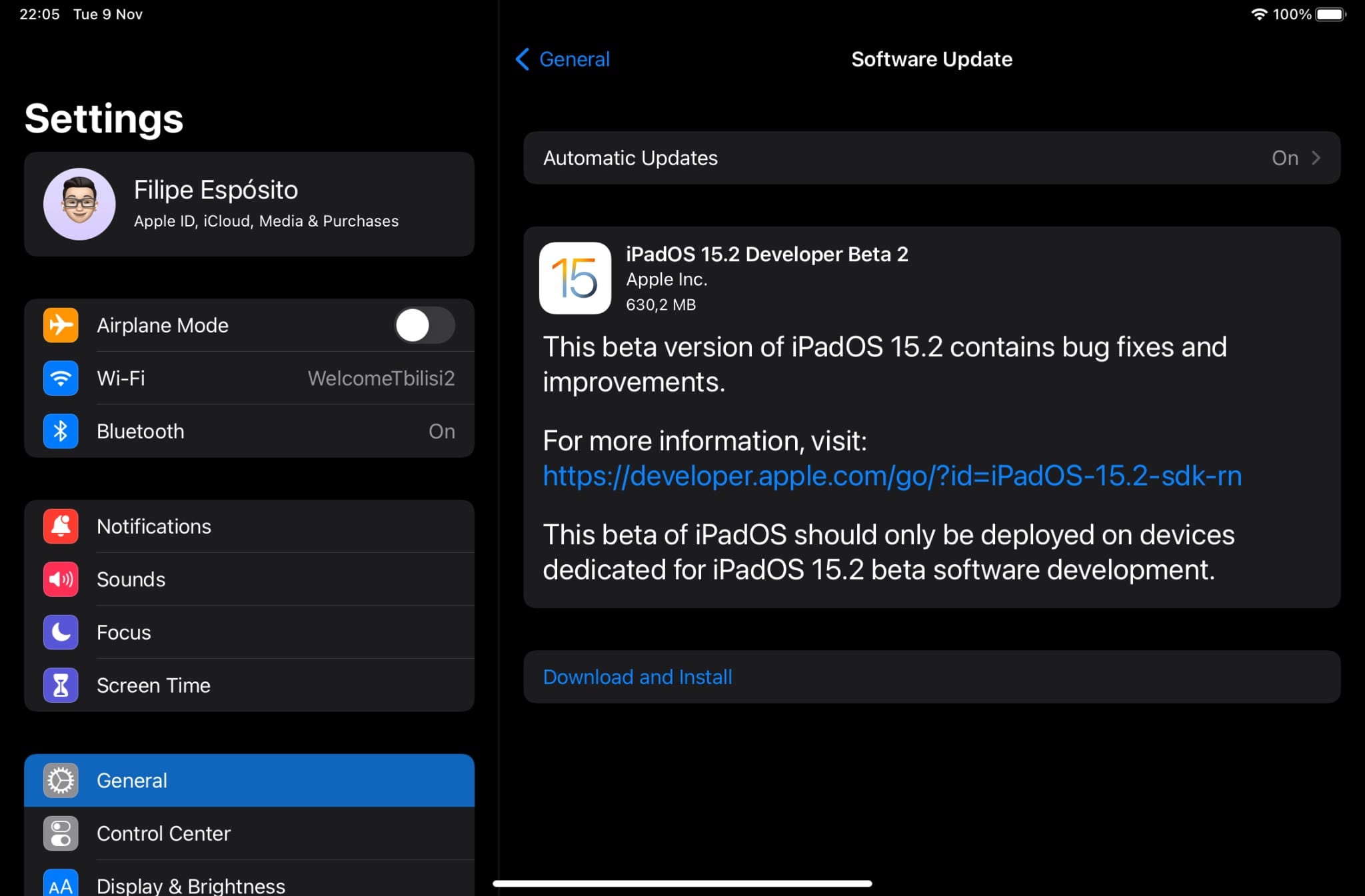 iOS 15.2 beta 2, yeni özelliklerle yayınlandı - ShiftDelete.Net